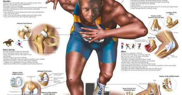 Sports Injuries Anatomy Poster | Arthipo